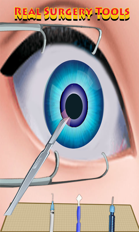 Cataract Eye Surgery Simulator - App on Amazon Appstore