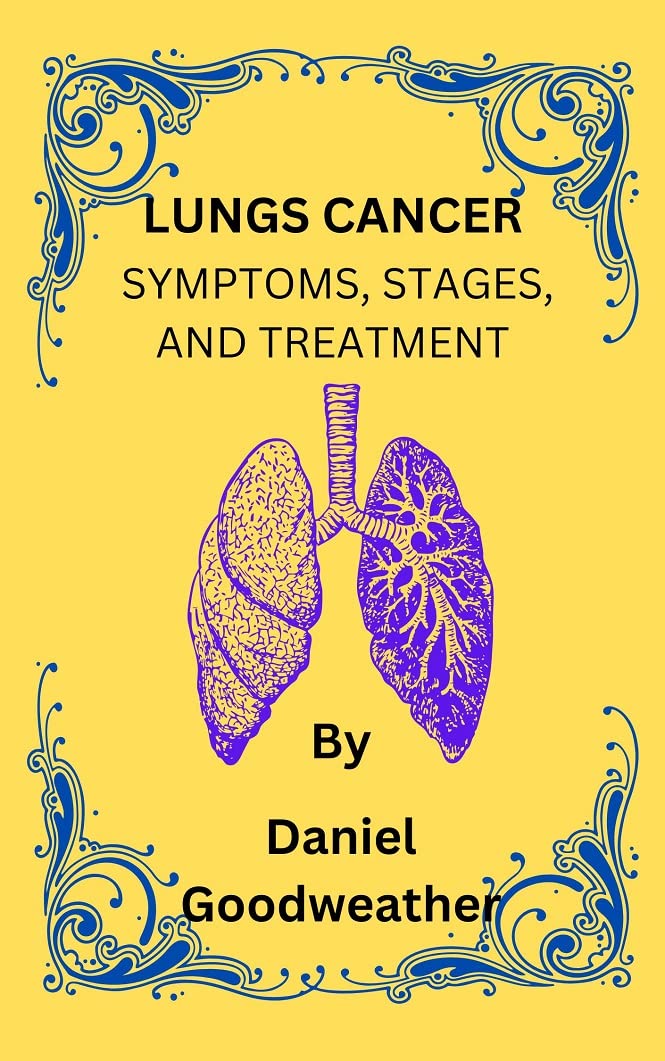 Amazon.com: LUNGS CANCER: SYMPTOMS, STAGES, AND TREATMENT eBook ...