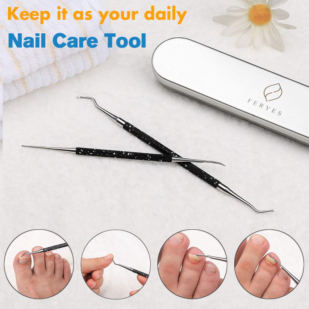 Ingrown Toenail Tools,Toenail Lifter and Toenail File Set for Ingrown ...