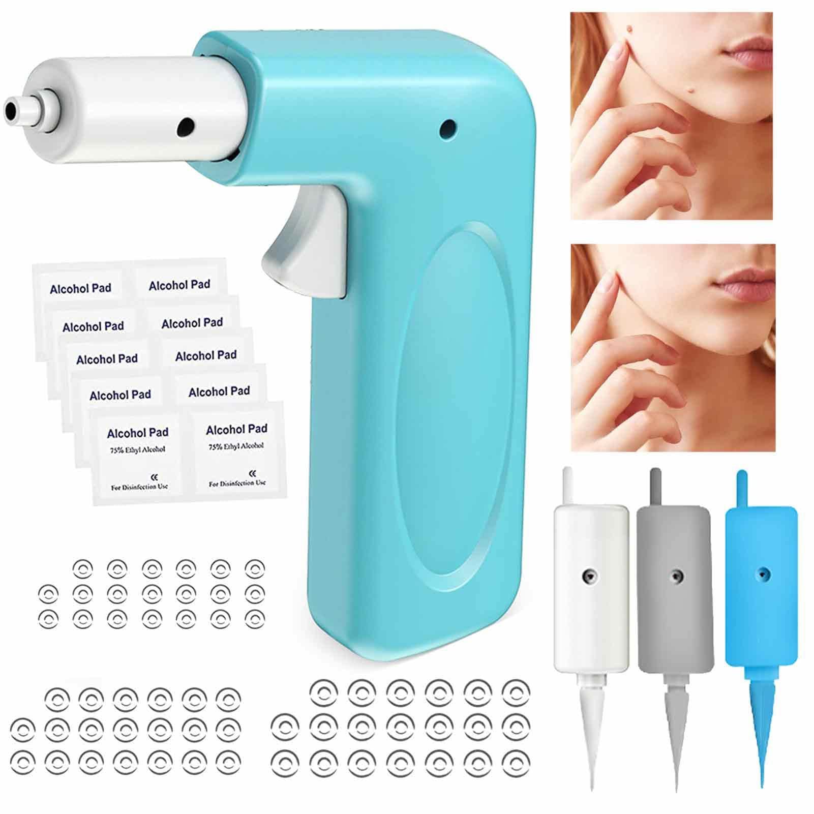 Skin Mole Removal Kit,Skin Tags Remover - Skin Tags Removal Kit with 60 ...
