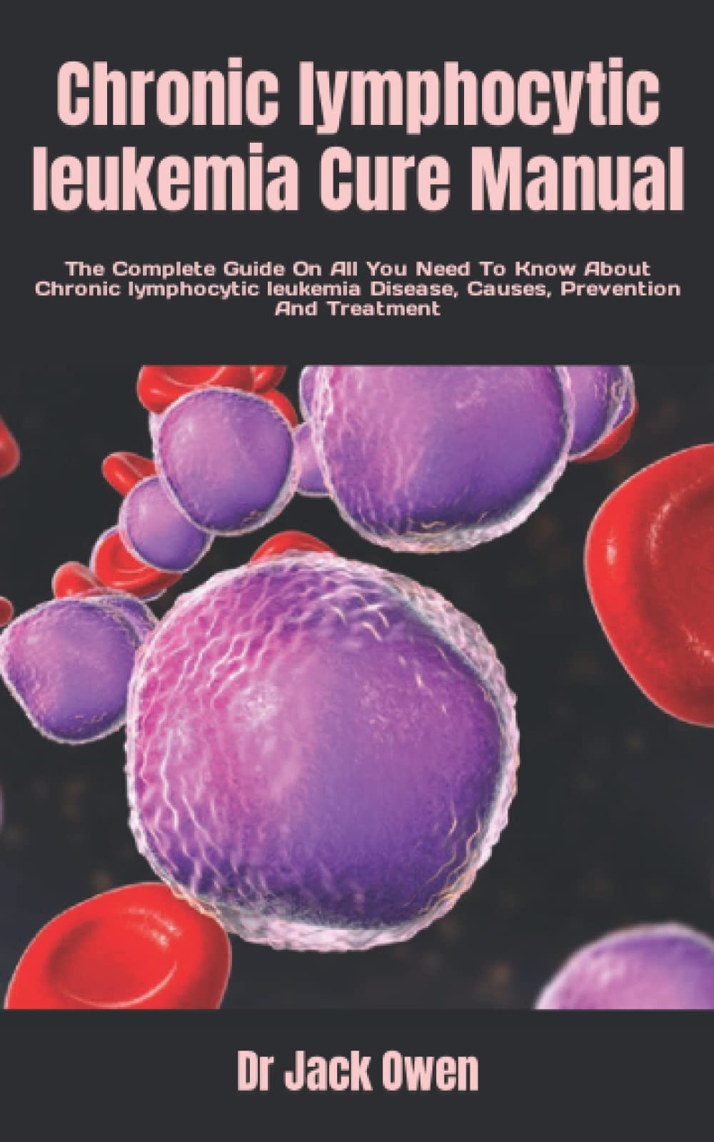 Buy Chronic lymphocytic leukemia Cure Manual: The Complete Guide On All ...