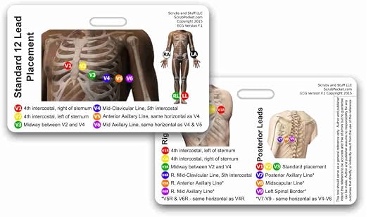 Scrubs and Stuff EKG Placement Badge Reference Card - Plastic - Future ...
