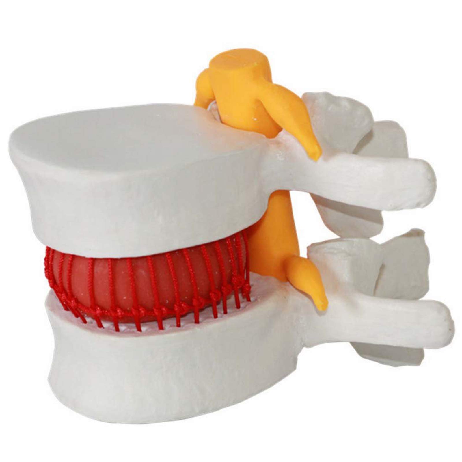 Buy UUK 1.5 Times Human Lumbar Spine Model Tool, Lumbar Disc Herniation ...