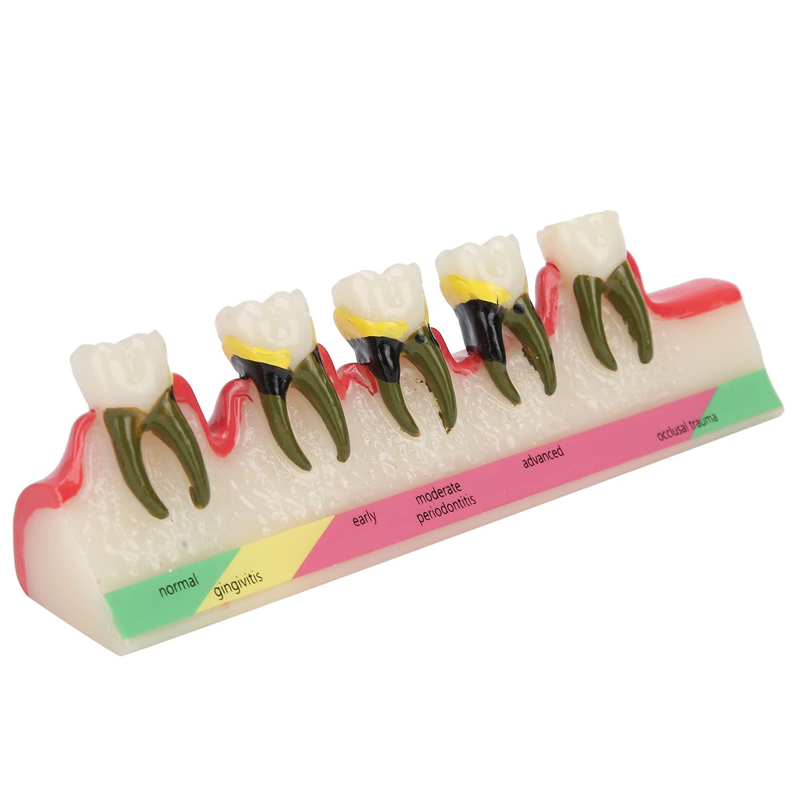 Buy Dental Model, Compact Portable Learning Display Teeth Model Safe ...