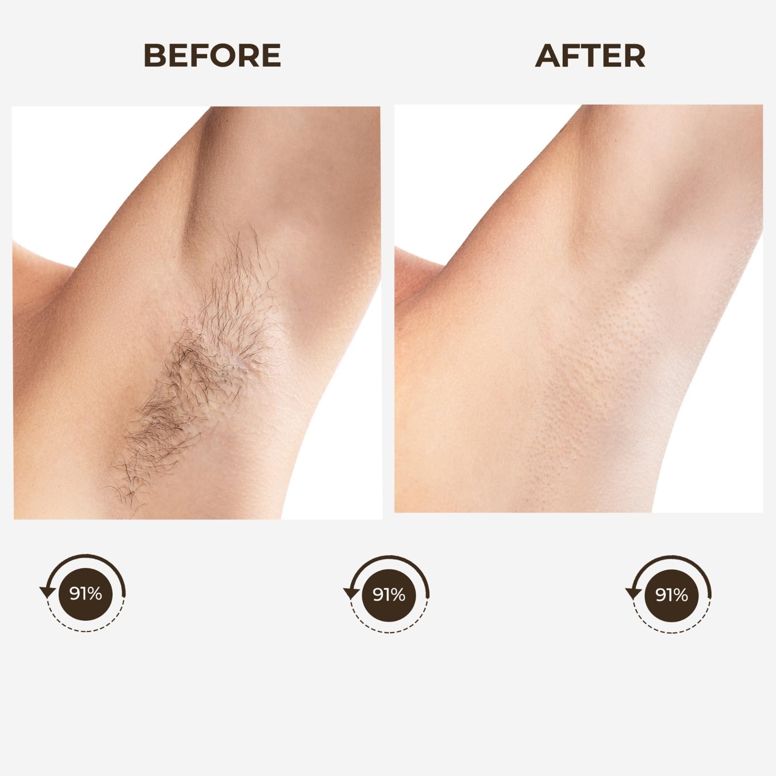 Brazilian Wax Pictures Before And After Photos Female (Vajacial) And