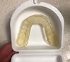 Polident Retainers Cleansing Tabs 84ct (Packaging May Vary) : Amazon.ca ...