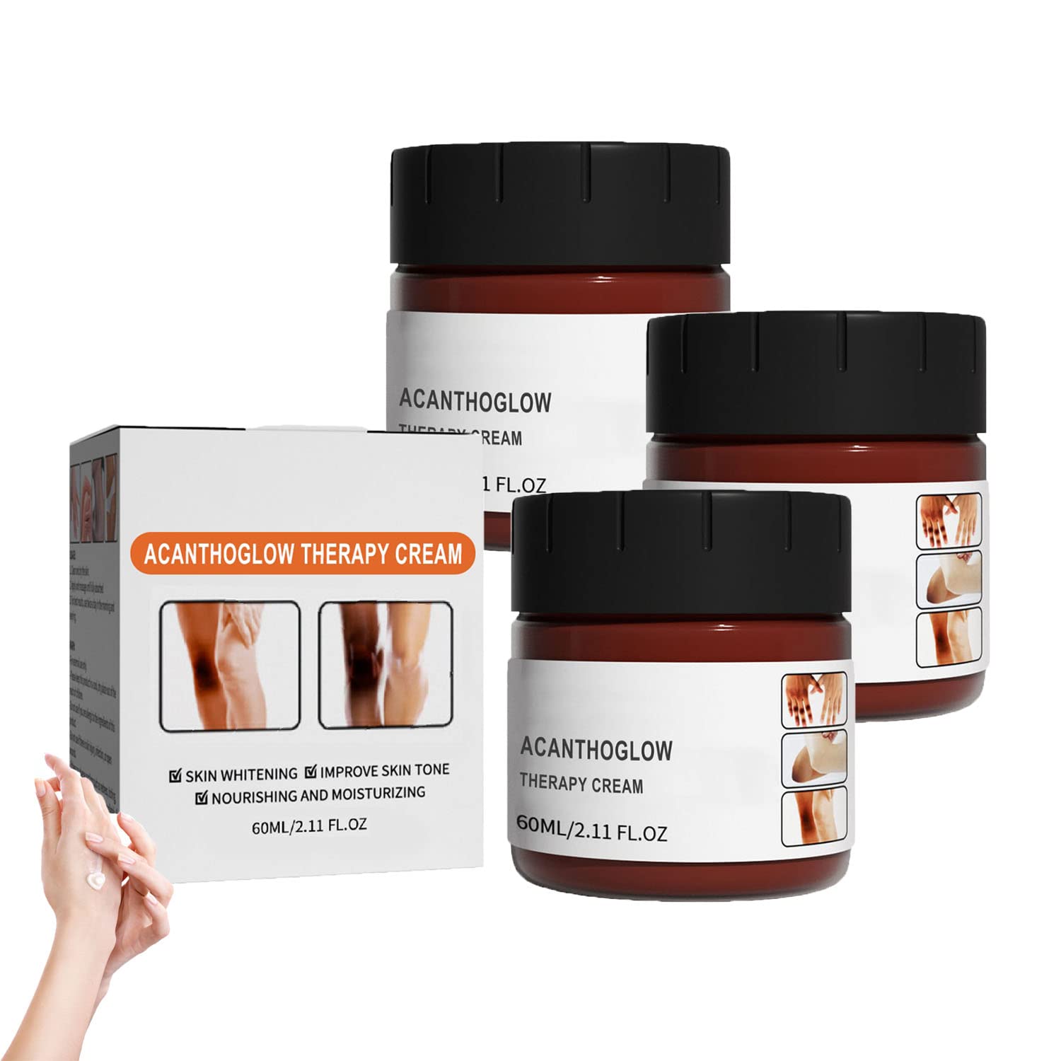 Amazon.com: GFOUK AcanthoGlow Therapy Cream, 120g - Dark Knees, Elbows ...