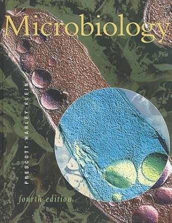 Buy Microbiology Book Online at Low Prices in India | Microbiology ...