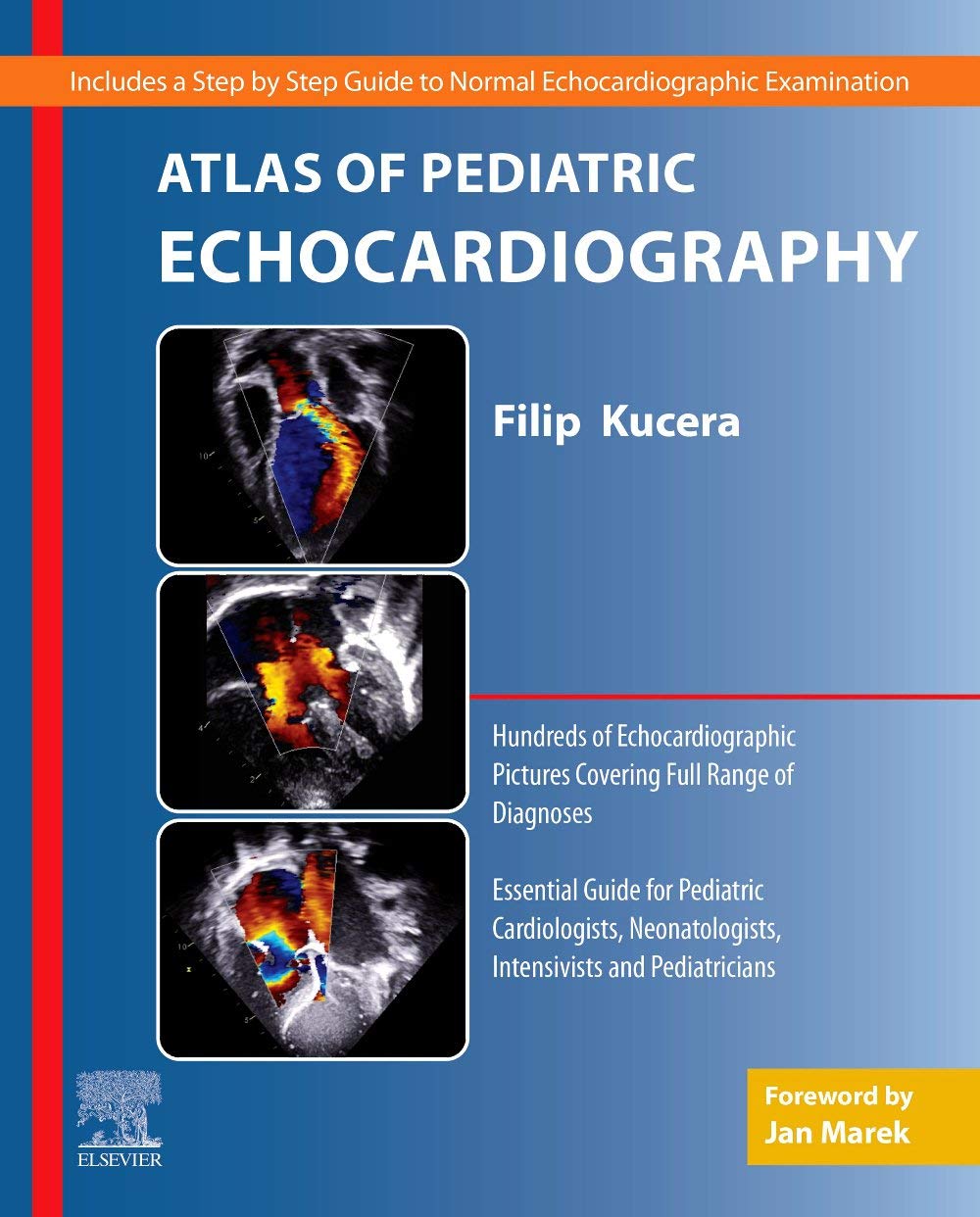 Buy ATLAS OF PEDIATRIC ECHOCARDIOGRAPHY (PB 2021) Book Online at Low ...
