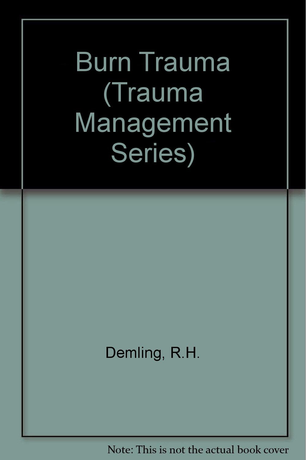 Burn Trauma (Trauma Management Series): Robert H. Demling ...