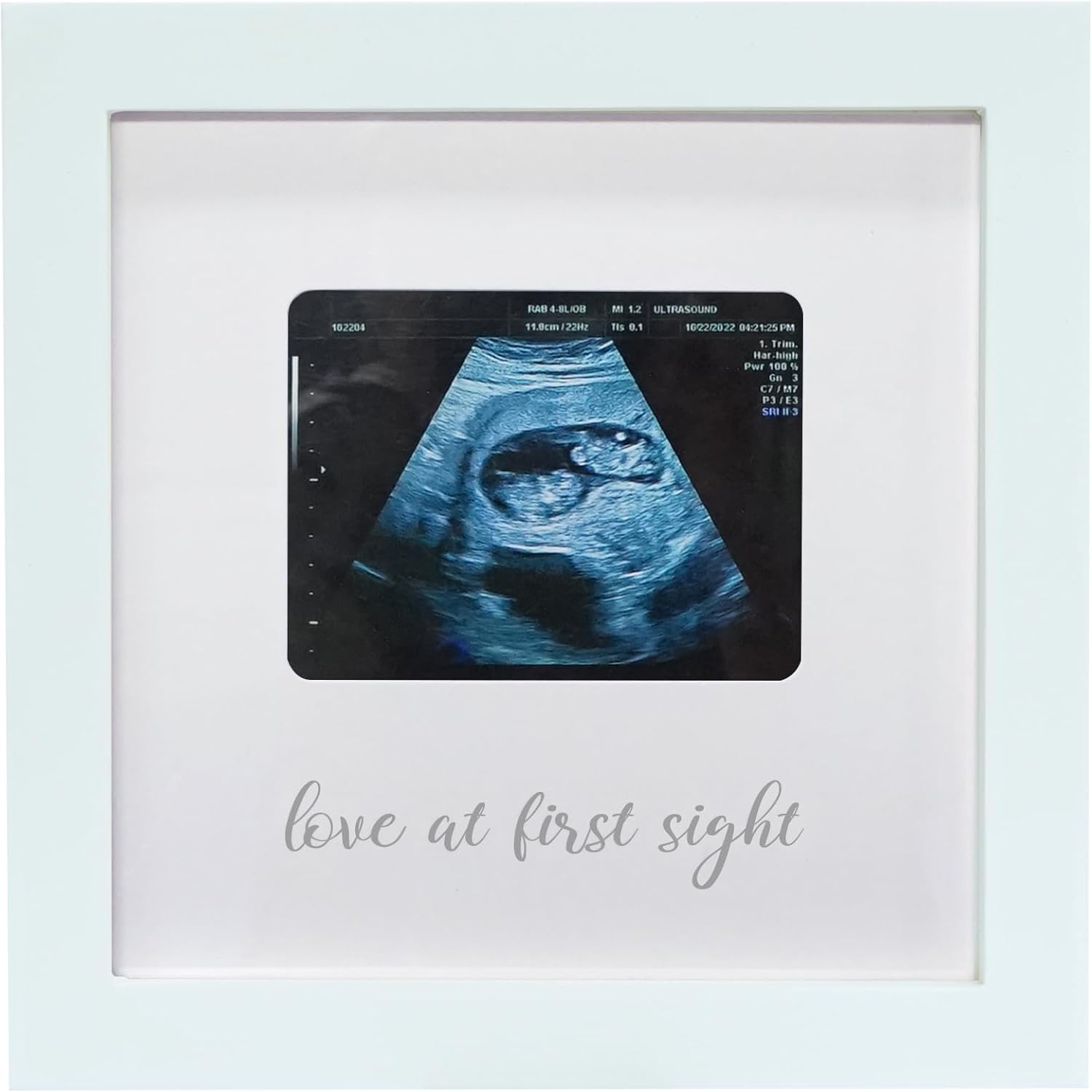 HAMUIERS Love at First Sight Ultrasound Picture Frames, Sonogram ...