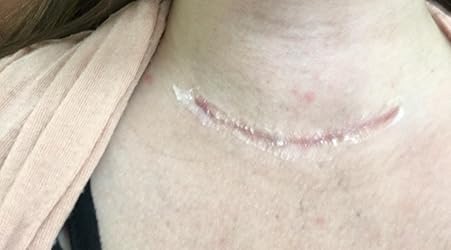 Amazon.com : Scarguard - Invisible Brush-On Silicone Sheet with Vitamin ...