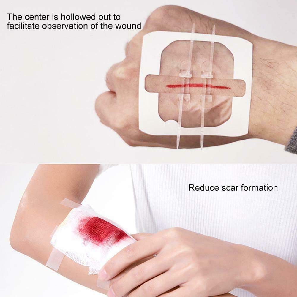 Zipper Band-aid Suture-Free, Zip Stitch Wound Closure kit, Surgical ...