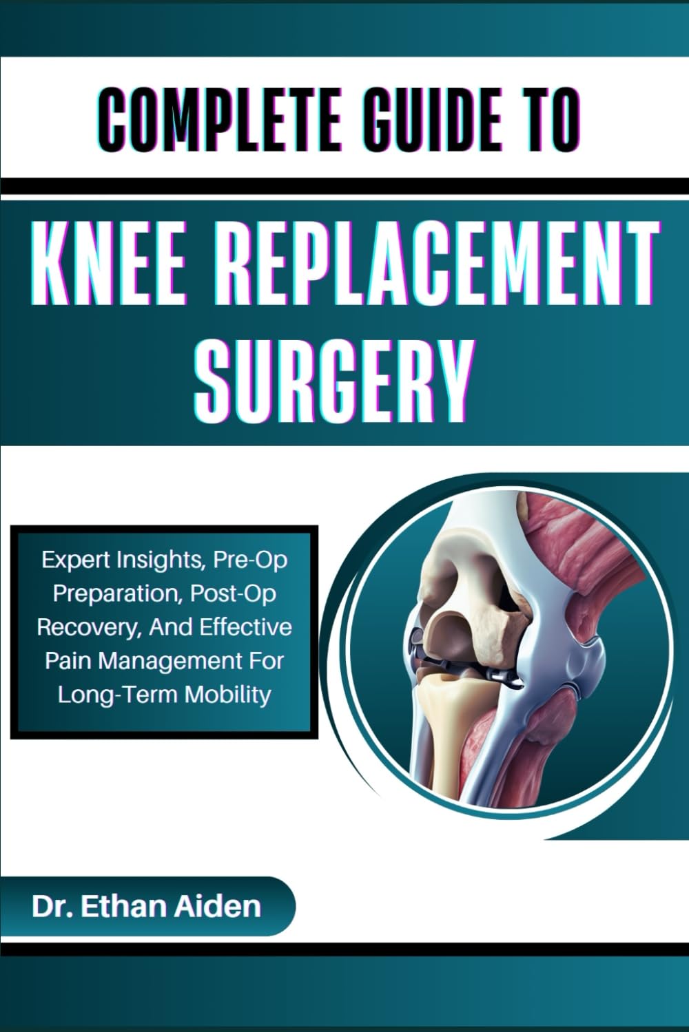 COMPLETE GUIDE TO KNEE REPLACEMENT SURGERY: Expert Insights, Pre-Op ...