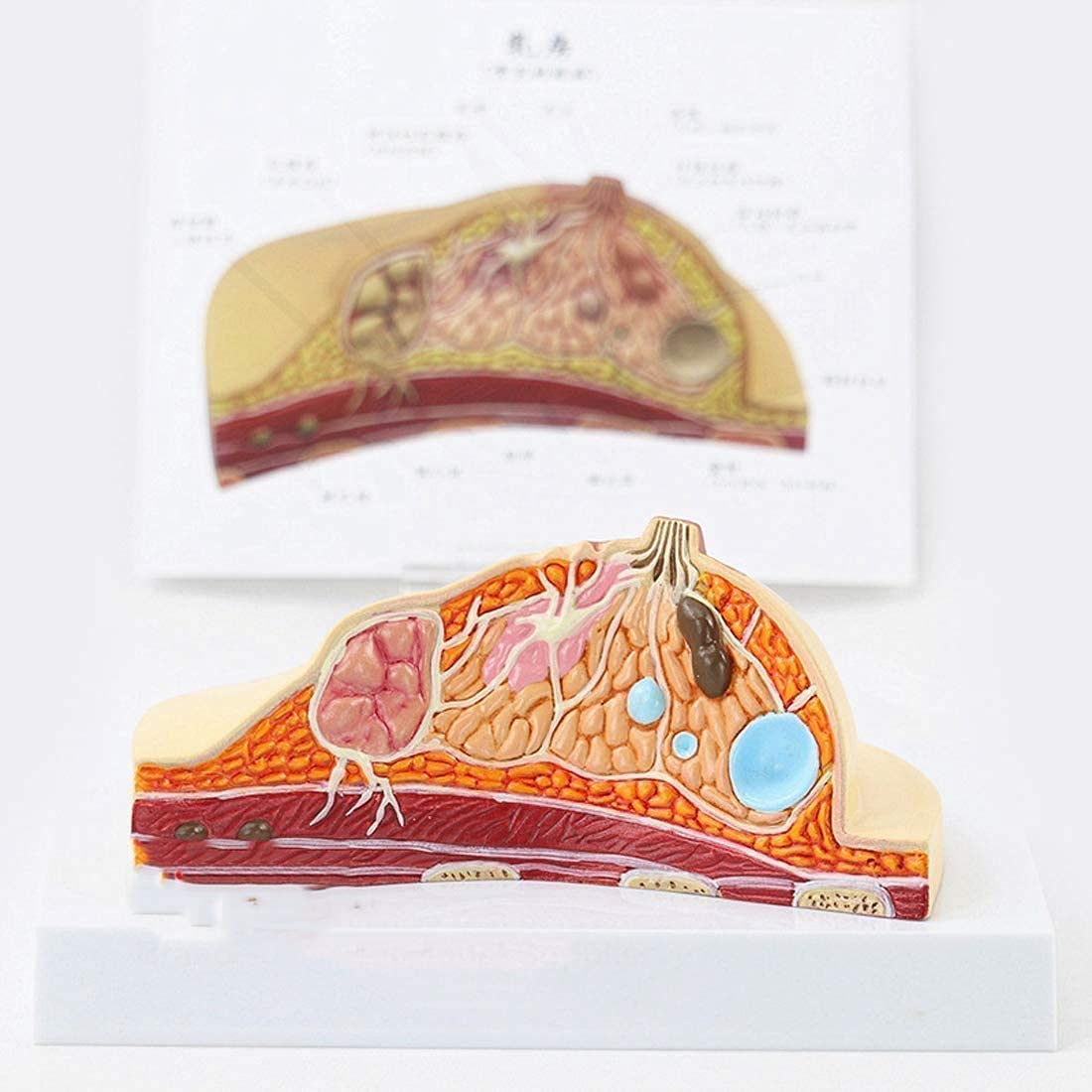 Buy Medical Models, Educational Model Female Lesions Pathology Anatomy ...