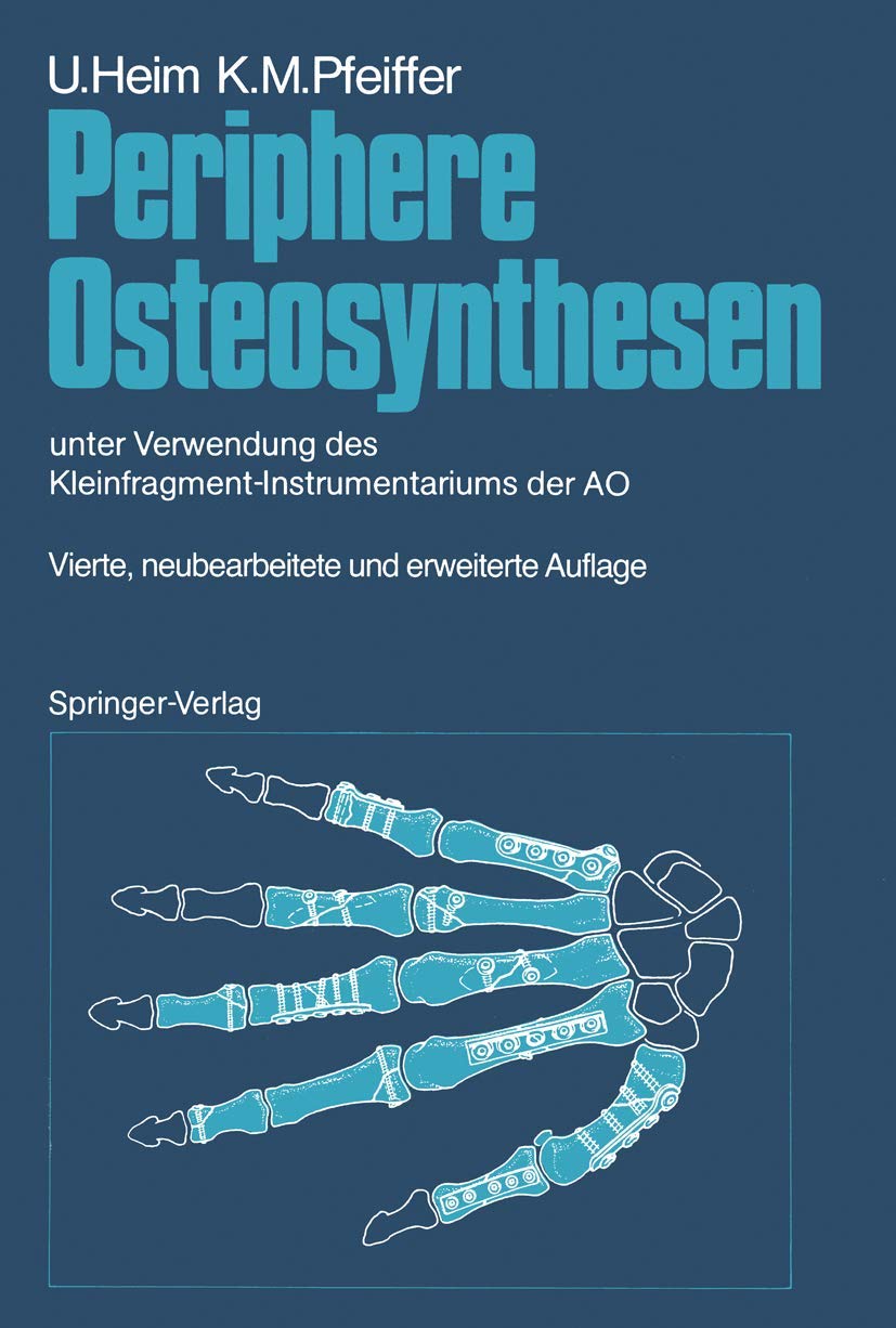 Periphere Osteosynthesen: unter Verwendung des Kleinfragment ...