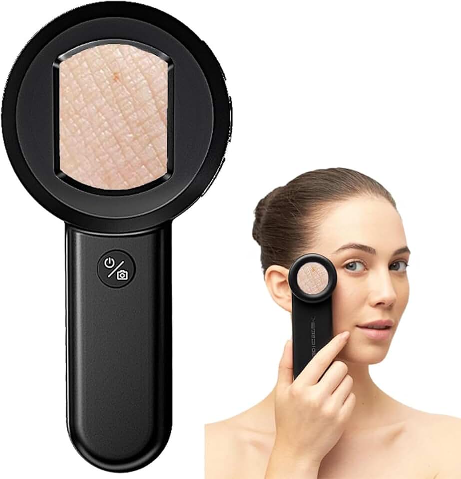 Amazon.ca: Dermatoscope