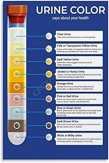 Propofol's Impact On Urine: Color Change And More | MedShun