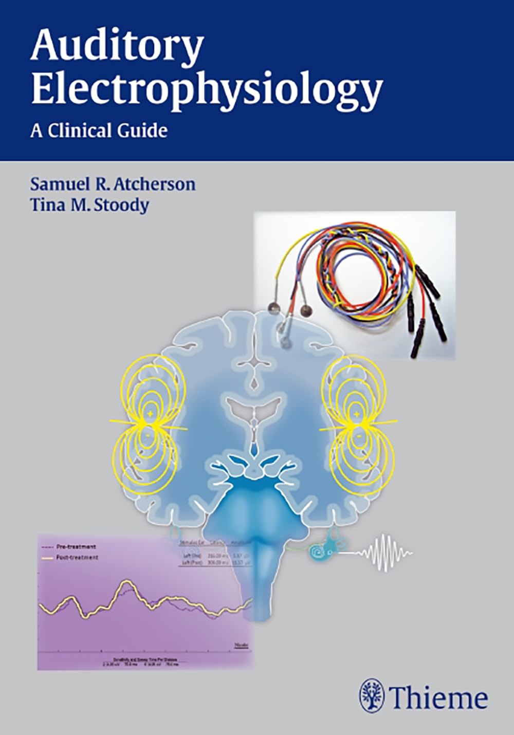Amazon.com: Auditory Electrophysiology: A Clinical Guide: 9781604063639 ...