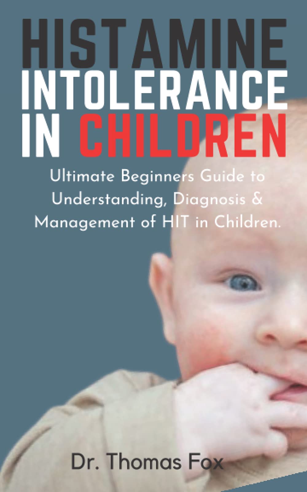 Buy Histamine Intolerance In Children: Ultimate Beginners Guide to ...