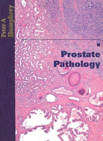 Prostate Pathology: 9780891894391: Medicine & Health Science Books ...