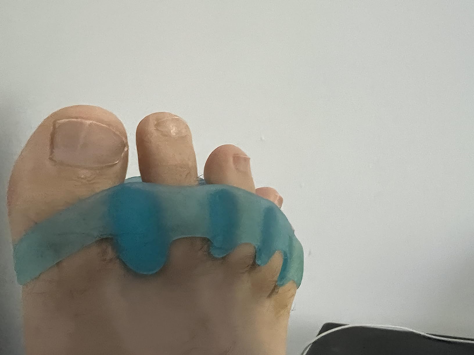 Toe Separator, 4-Pack Toe Spacers & Toe Straightener Fight Bunions and ...