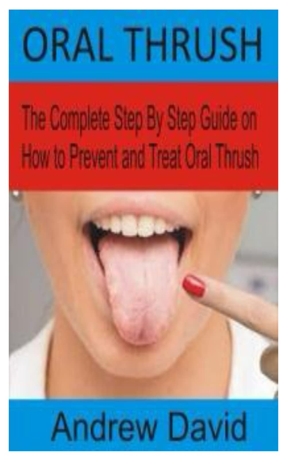 Buy Oral Thrush: The Complete Step By Step Guide on How to Prevent and ...