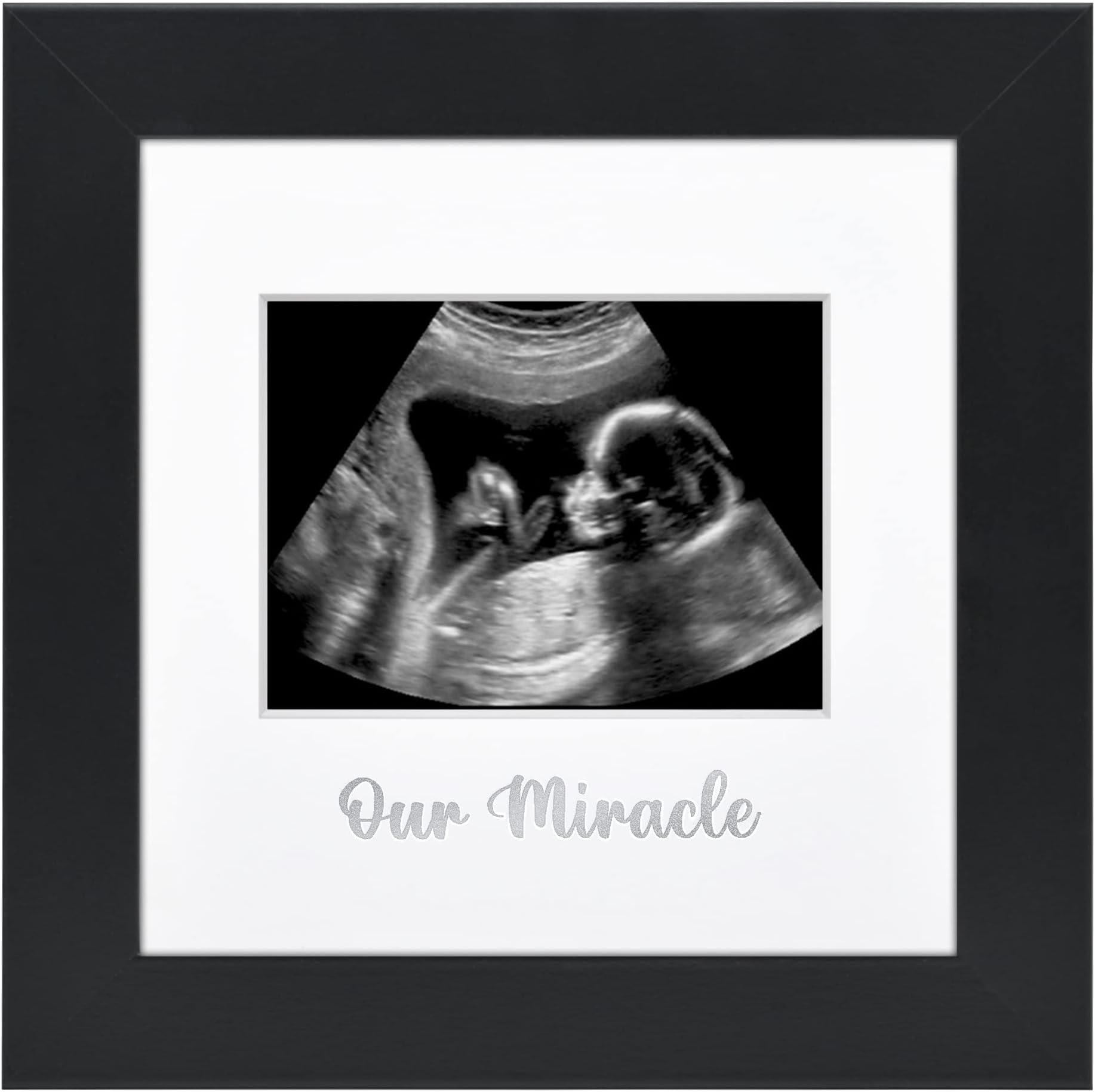 Amazon.com : I’m Solid Wood Sonogram Pregnancy Baby Ultrasound 2 Sided ...