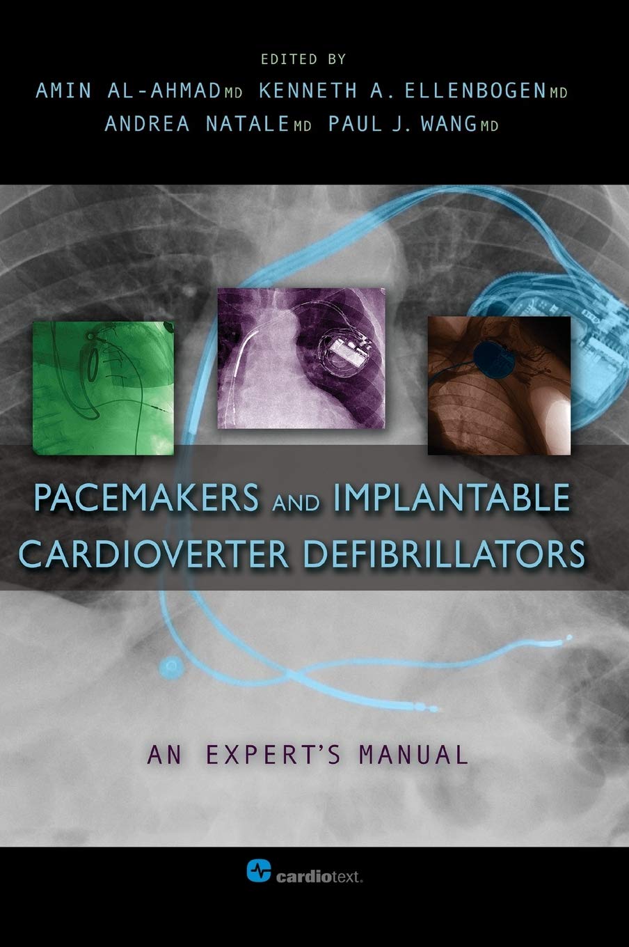 Pacemakers and Implantable Cardioverter Defibrillators: An Expert's ...
