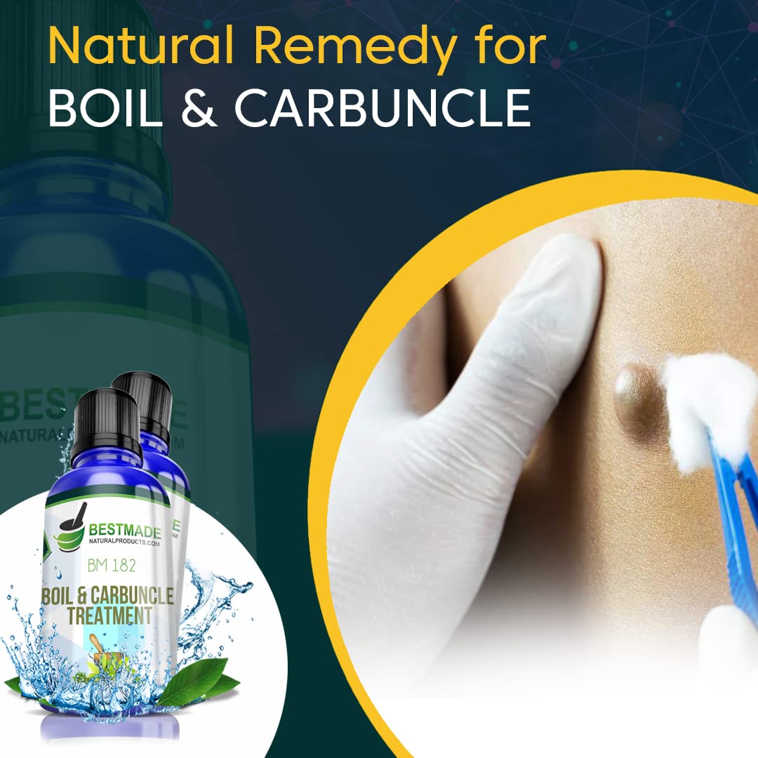 Carbuncles Treatment Carbuncles: How To Treat Them?