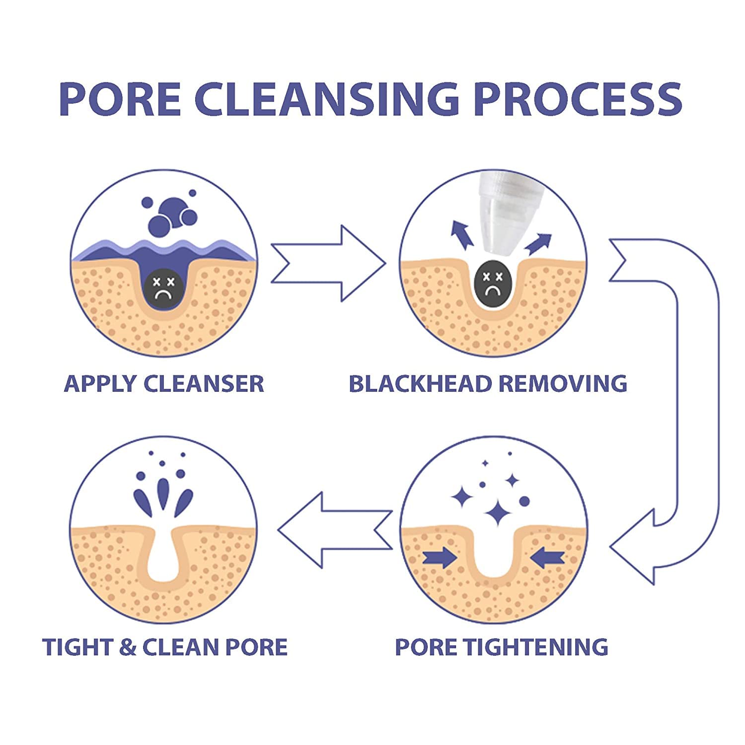 Blackhead Diagram Blackheads On Nose Treatment Before And After Vector