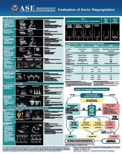 Evaluation of Aortic Regurgitation Poster: American Society of ...