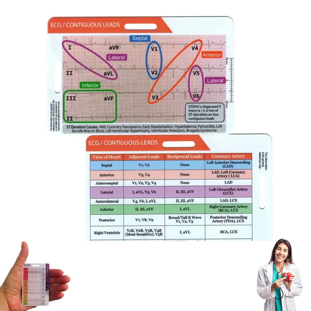 Amazon.com : ECG/EKG Rhythm Pocket Card, 12-Lead STEMI Reference Tool ...