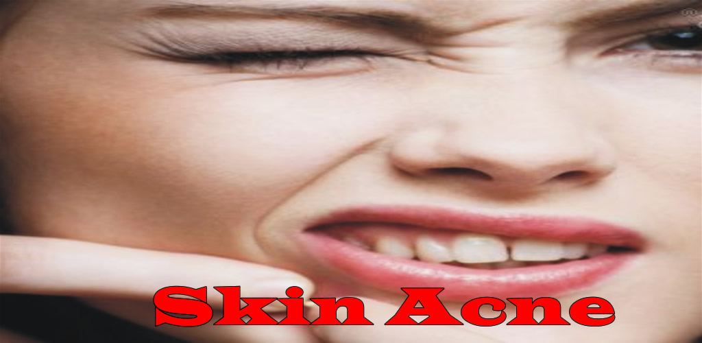 Skin Acne:Amazon.com:Appstore for Android