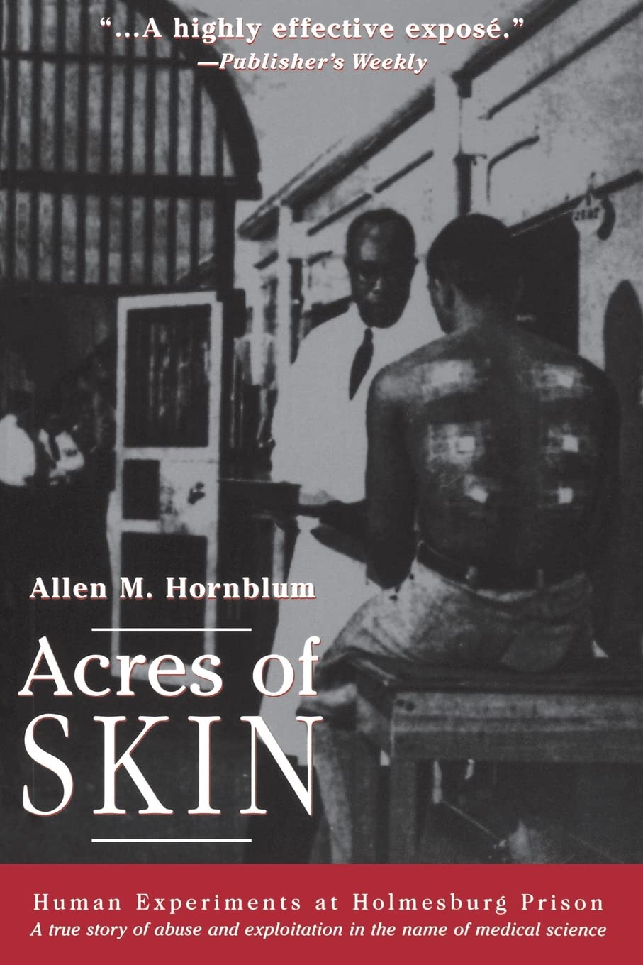 Snapklik.com : Acres Of Skin: Human Experiments At Holmesburg Prison