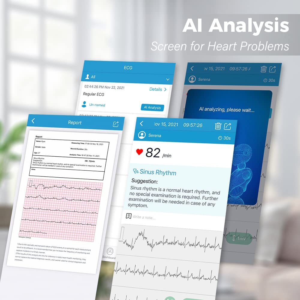 Wellue BP2 Connect - Blood Pressure Monitor + AI-ECG | Wi-Fi ...