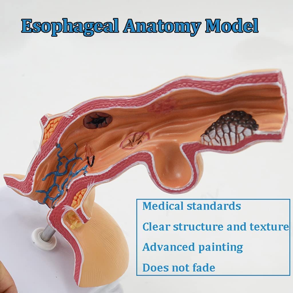 Esophagus Model Labeled