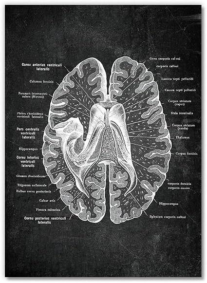 Anatomical Brain Neurology Poster Human Brain Structure Medical Art ...