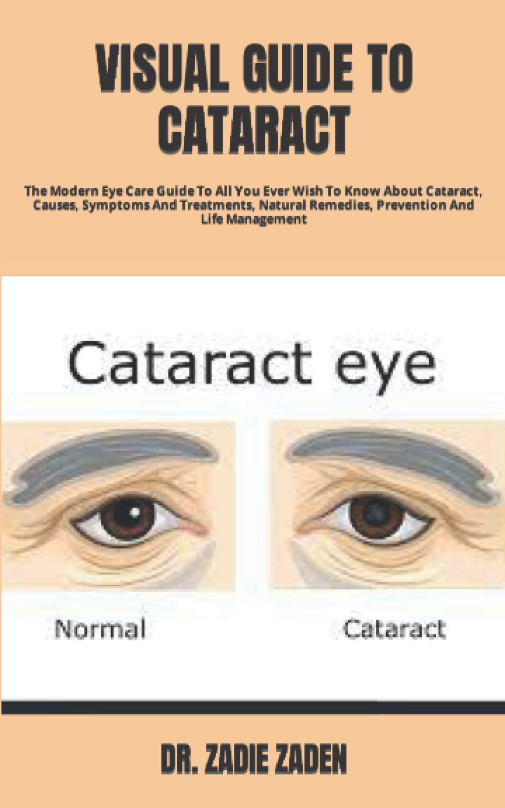 Buy VISUAL GUIDE TO CATARACT: The Modern Eye Care Guide To All You Ever ...
