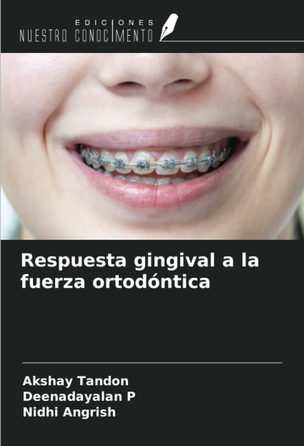Respuesta gingival a la fuerza ortodóntica (Spanish Edition): Tandon ...