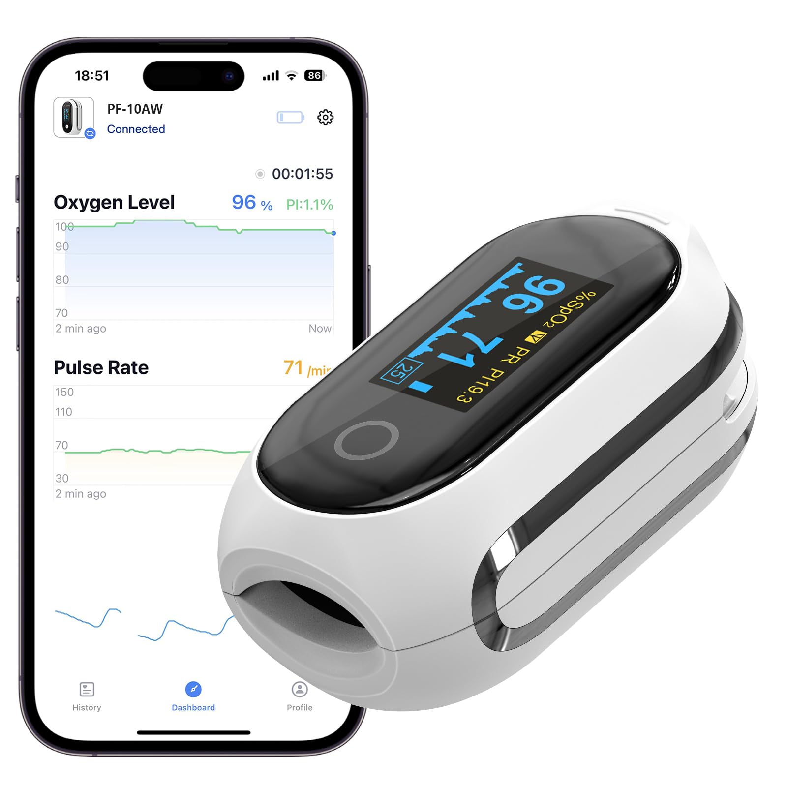 Vibeat Bluetooth Pulsoximeter mit 12 Offline-Daten, Wiederaufladbare ...