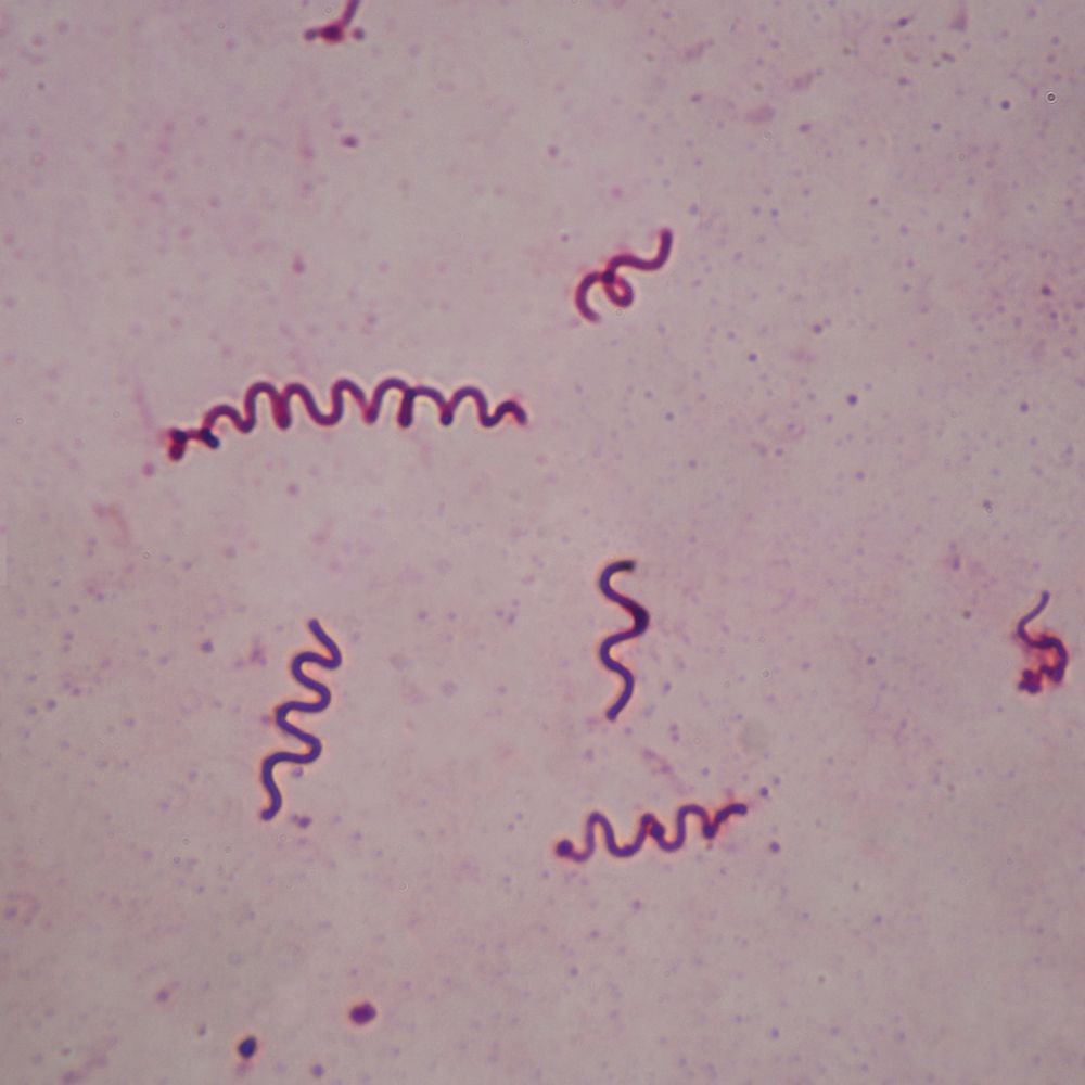 Spirillum Bacteria Under Microscope