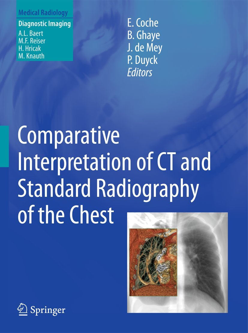Comparative Interpretation of CT and Standard Radiography of the Chest ...