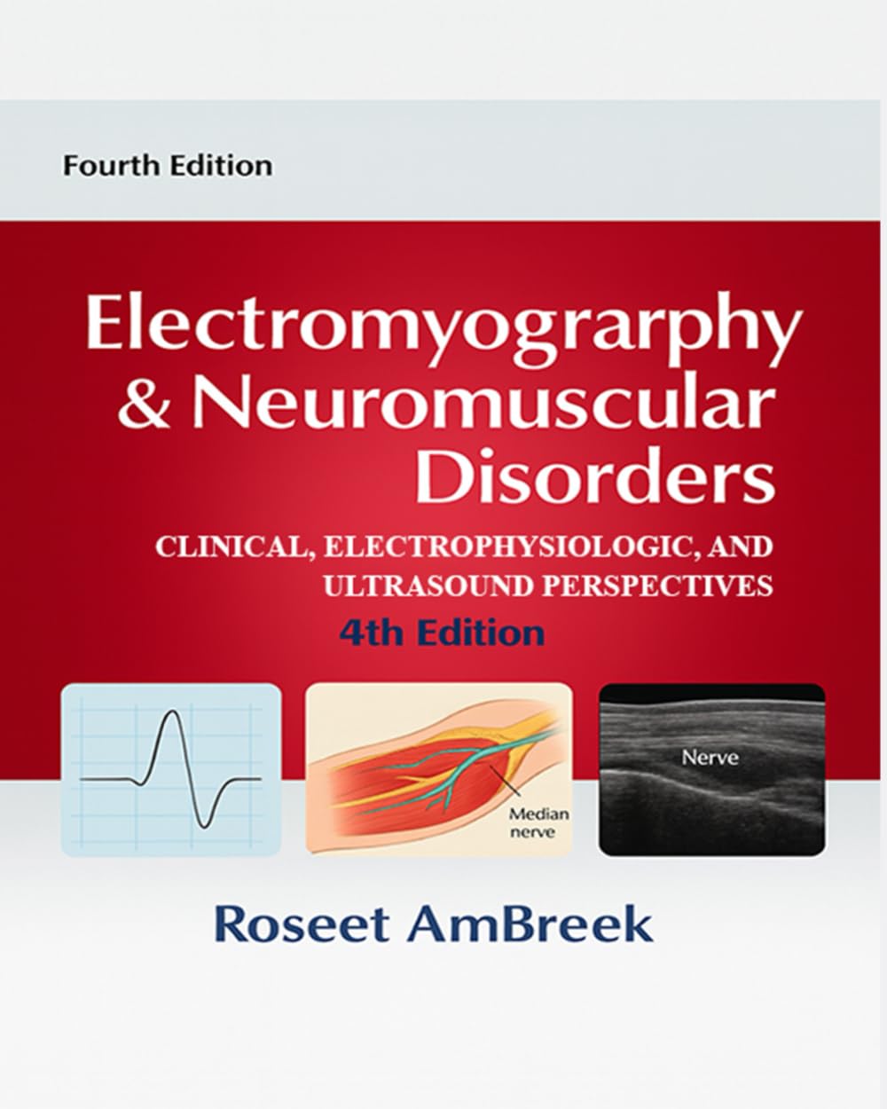 Electromyography & Neuromuscular Disorders: Clinical ...