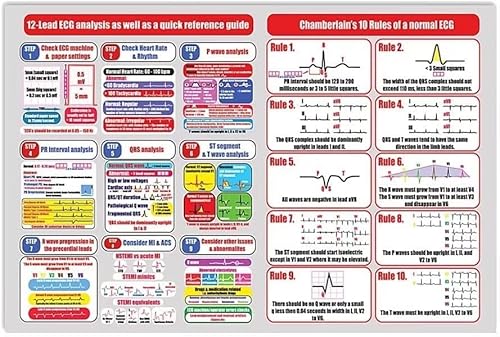 12-Lead ECG Analysis Frameless Posters As Well As A Quick Reference ...