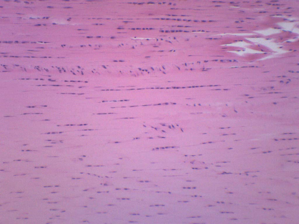 Dense Regular Connective Tissue 400x Labeled