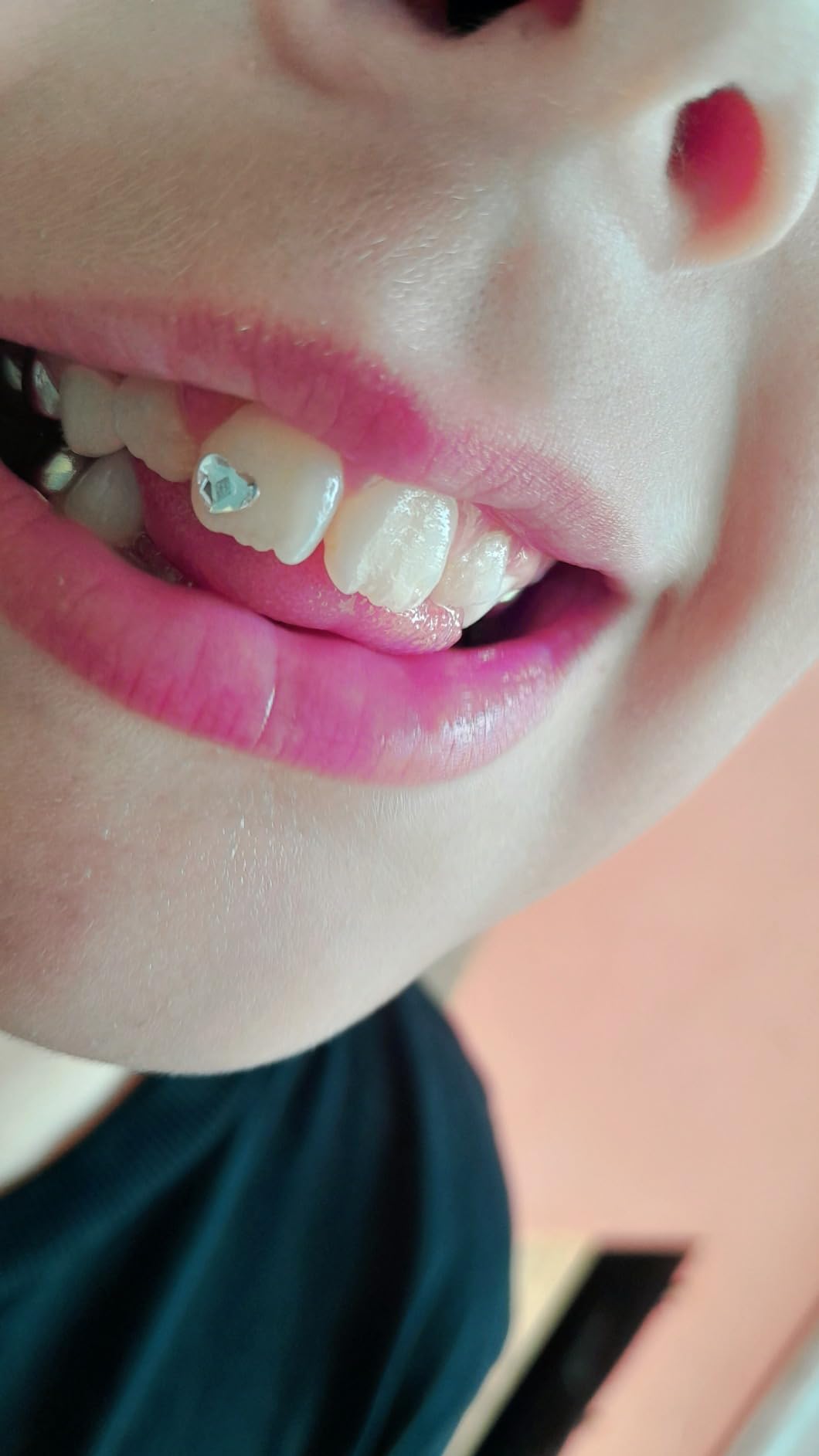 ICYBOSS Tooth Gem Kit, DIY starter kit, temporary teeth jewellery ...