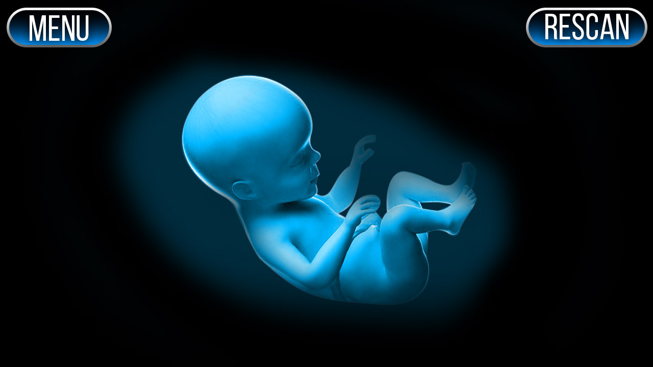 Xray Scanner Pregnant Prank - App on Amazon Appstore