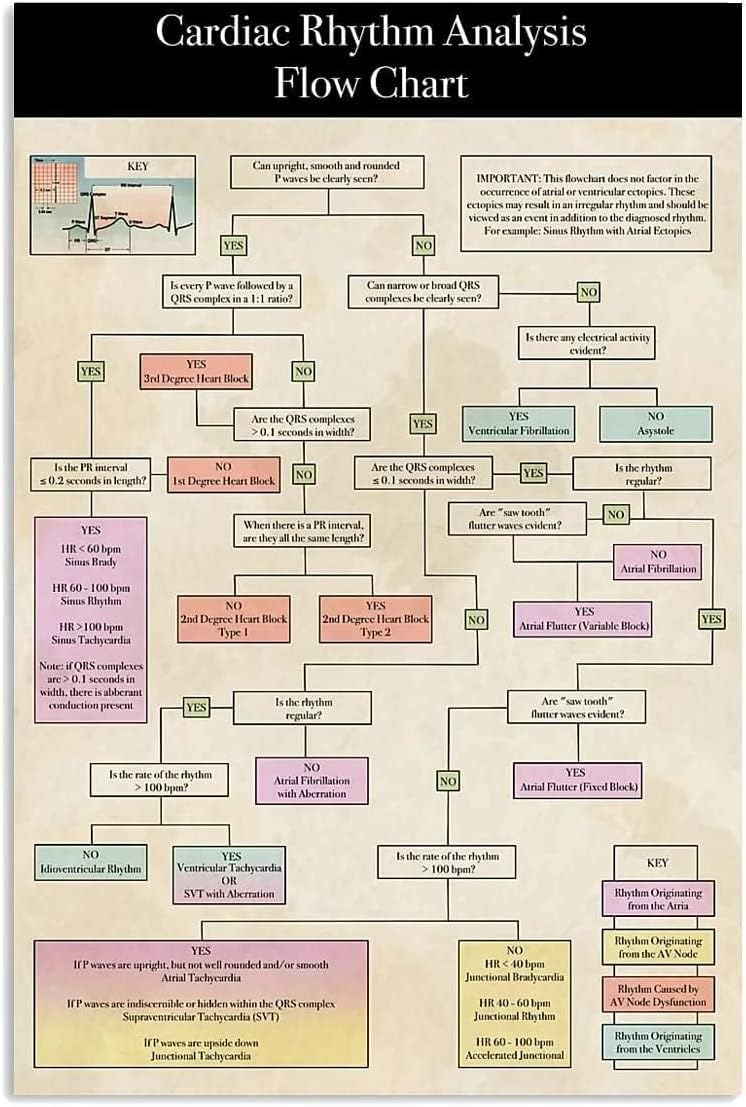Amazon.com: Starotore Heart Rhythm Analysis Flow Chart Frameless ...