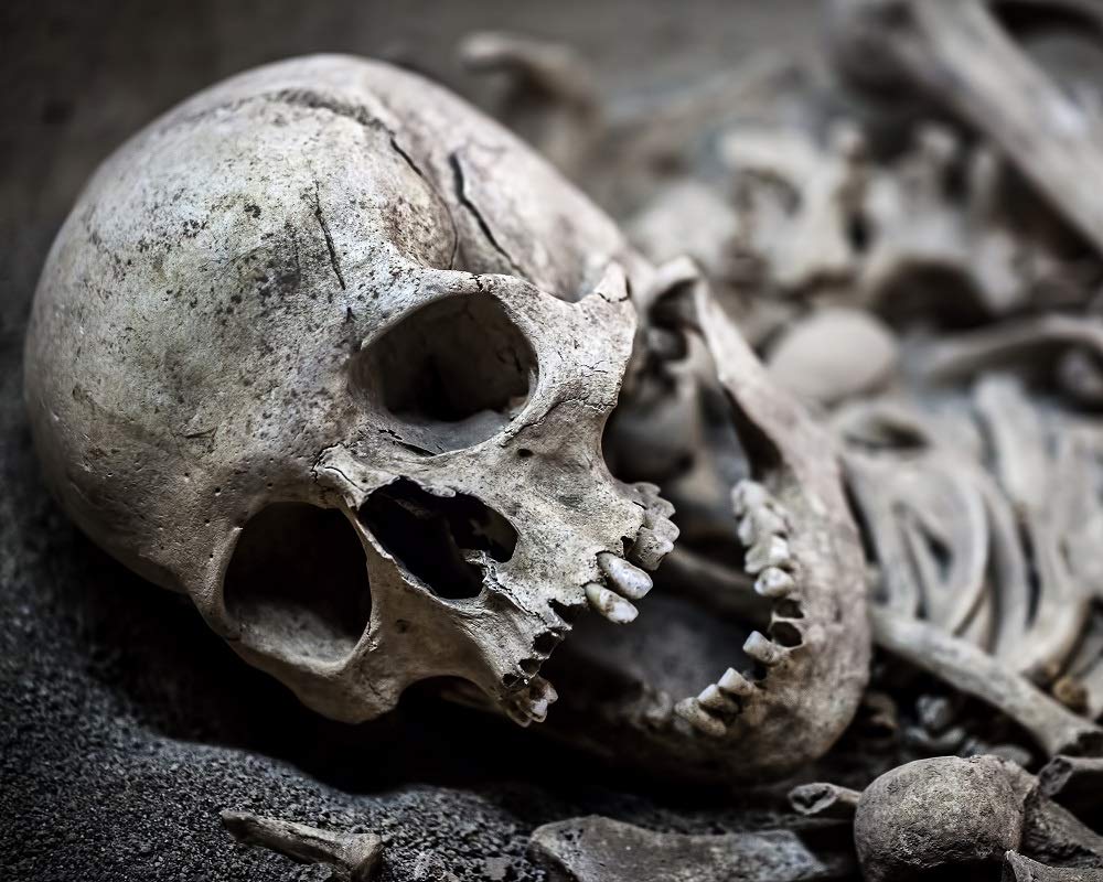 Amazon.com: Skeleton Bones 504 Piece Jigsaw Puzzle 16" X 20" : Toys & Games